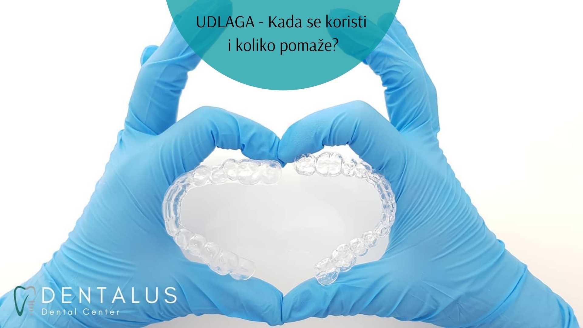 UDLAGA - Kada se koristi i koliko nam pomaže? | DENTALUS